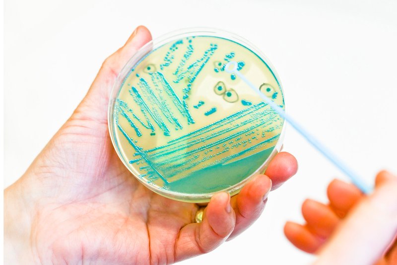 Microbial analysis - meat - Danish Technological Institute